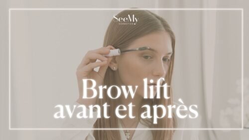 Brow lift avant apres : quel résultat?